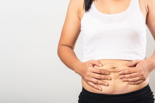 > TODO de una LIPECTOMIA -ANTES y DESPUÉS - DEPIEL | CIRUGIA PLÁSTICA